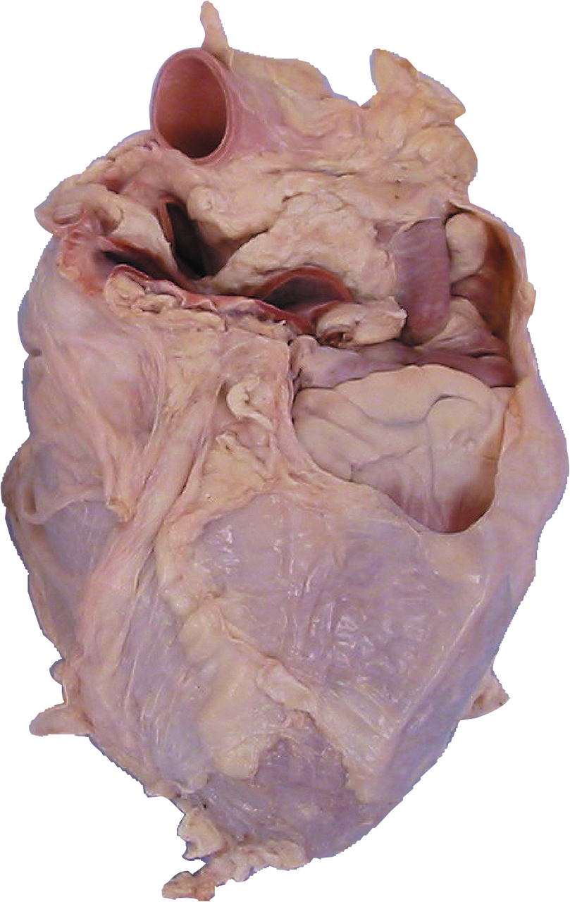 cadaver heart