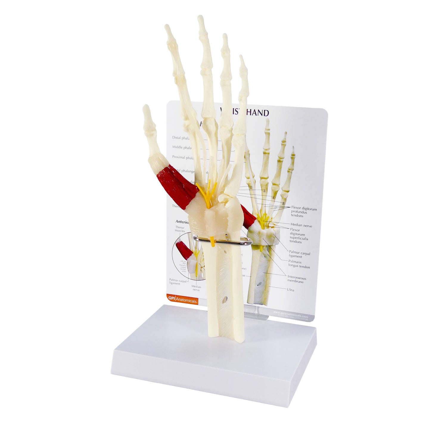 Model - Hand/Wrist (Carpal Tunnel Syndrome)