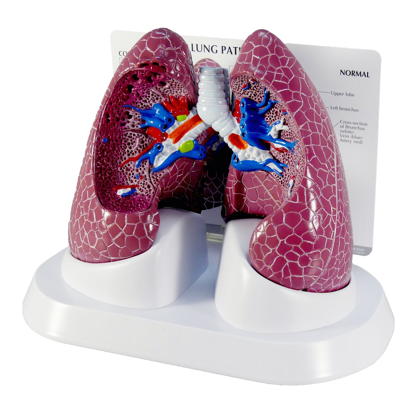 Model - Lung Set (with Pathologies)