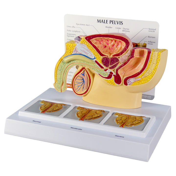 Model - Male Pelvis with 3D Prostate Frame