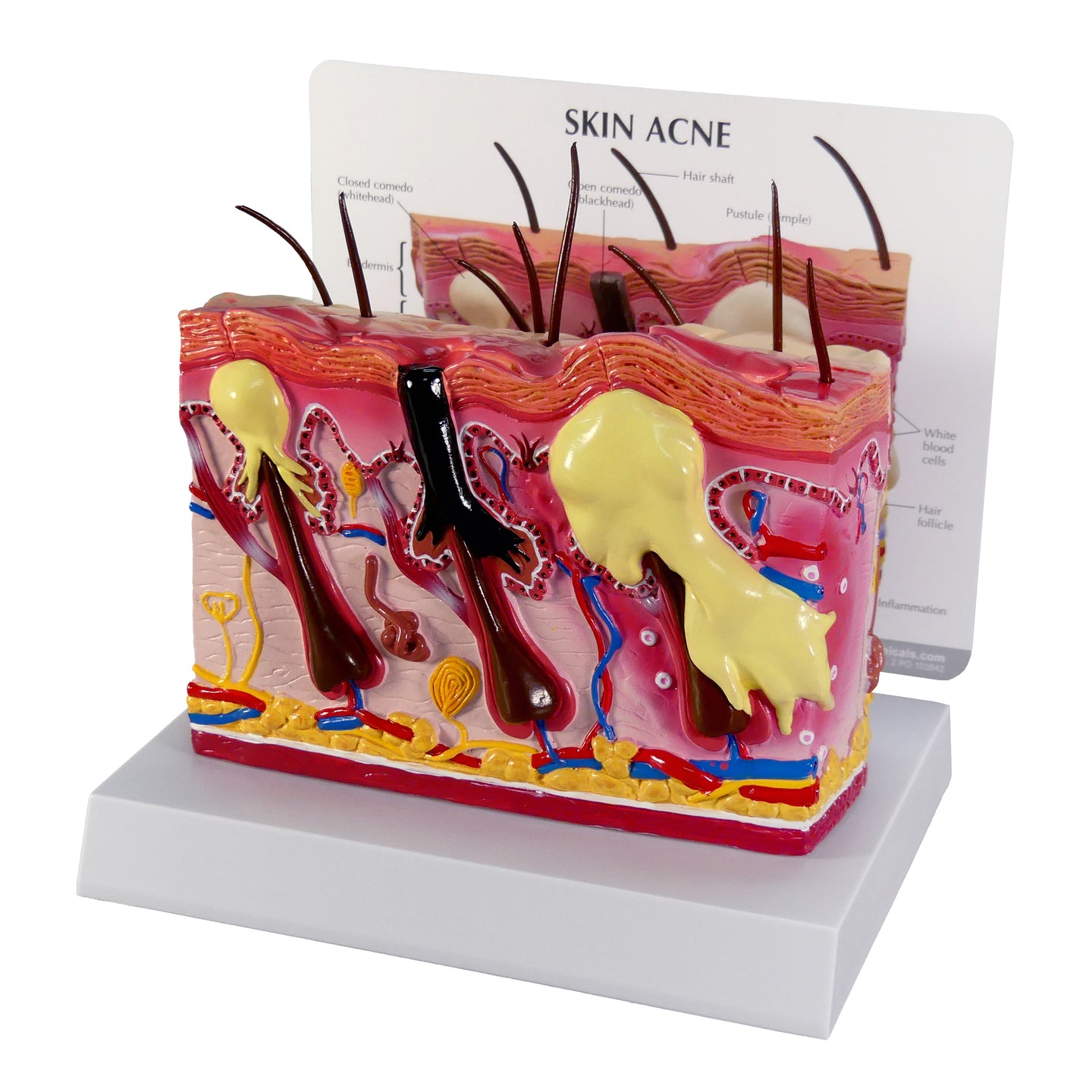 Model - Skin Acne & Normal Skin (2-Sided)