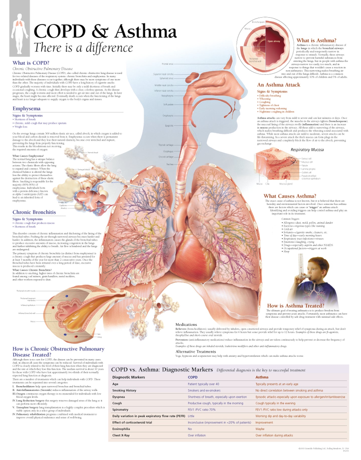 Chart - COPD/Asthma