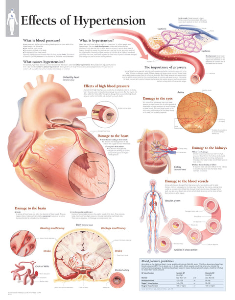 Chart - Effects of Hypertension