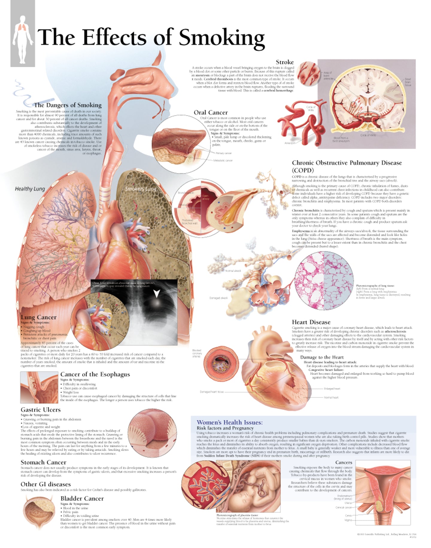 Chart Effects Of Smoking