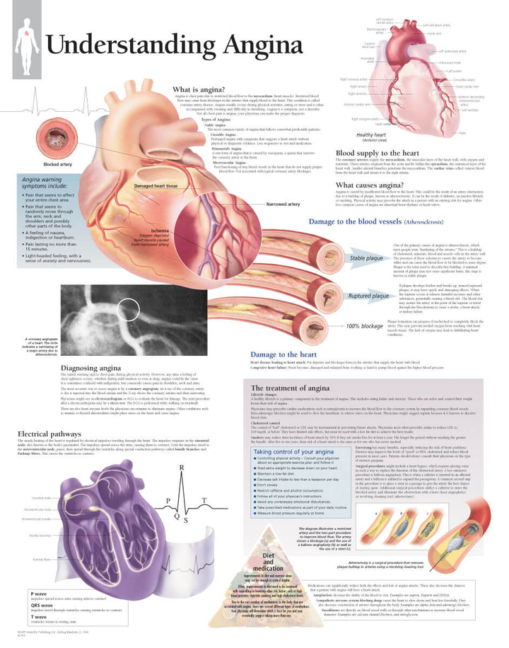 Chart - Understanding Angina