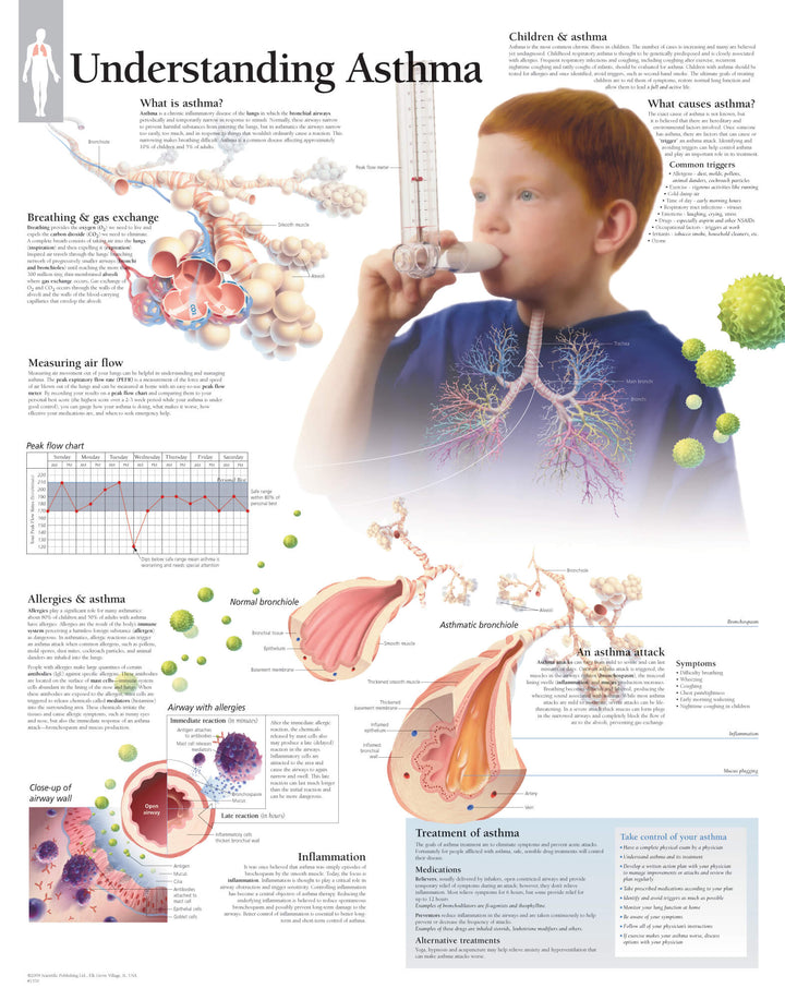 Chart - Understanding Asthma