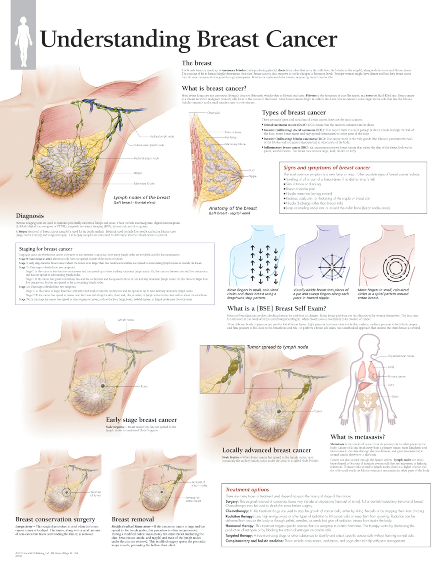 Chart - Understanding Breast Cancer