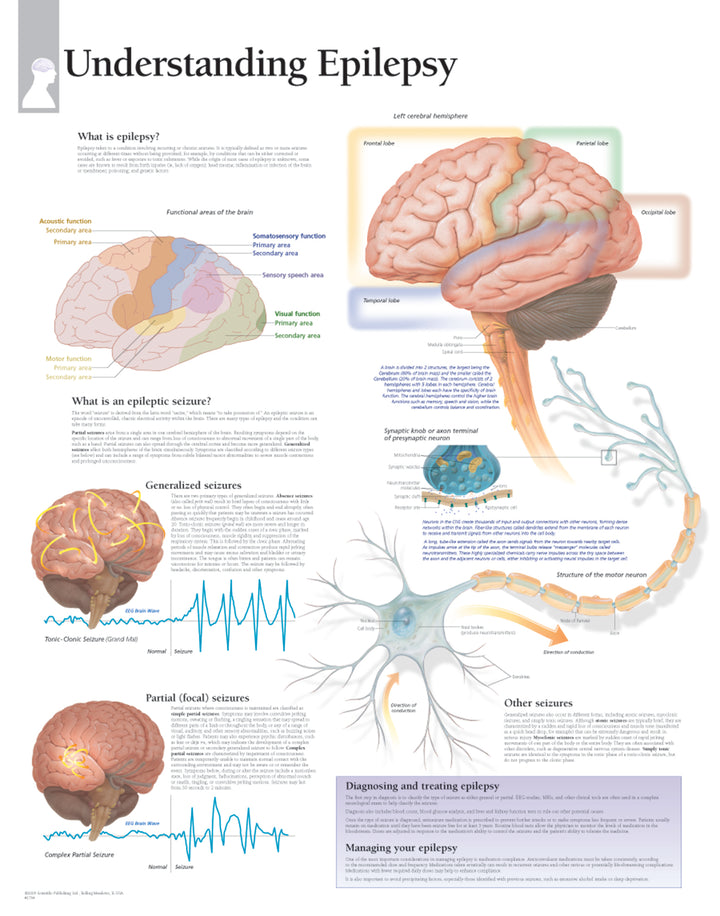 Chart Understanding Epilepsy