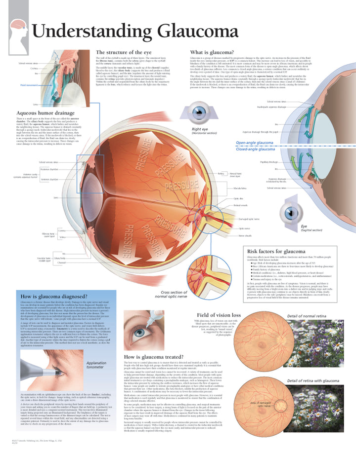 Chart - Understanding Glaucoma