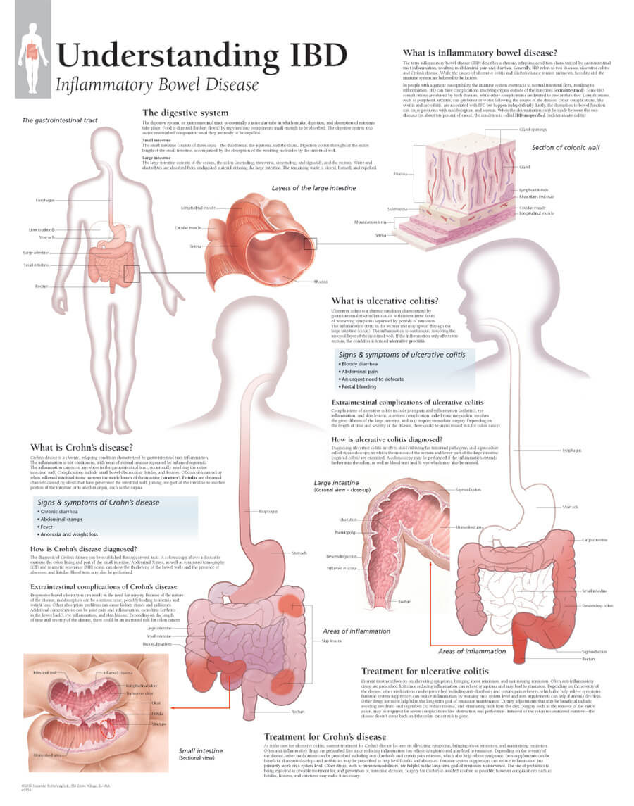 Chart - Understanding IBD
