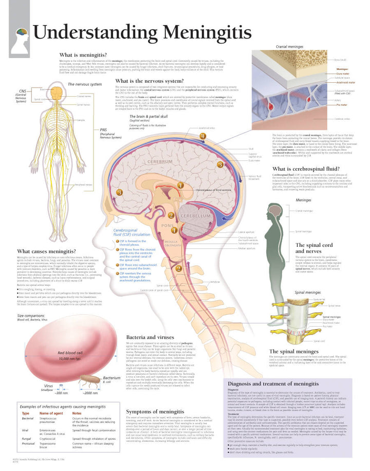 Chart - Understanding Meningitis