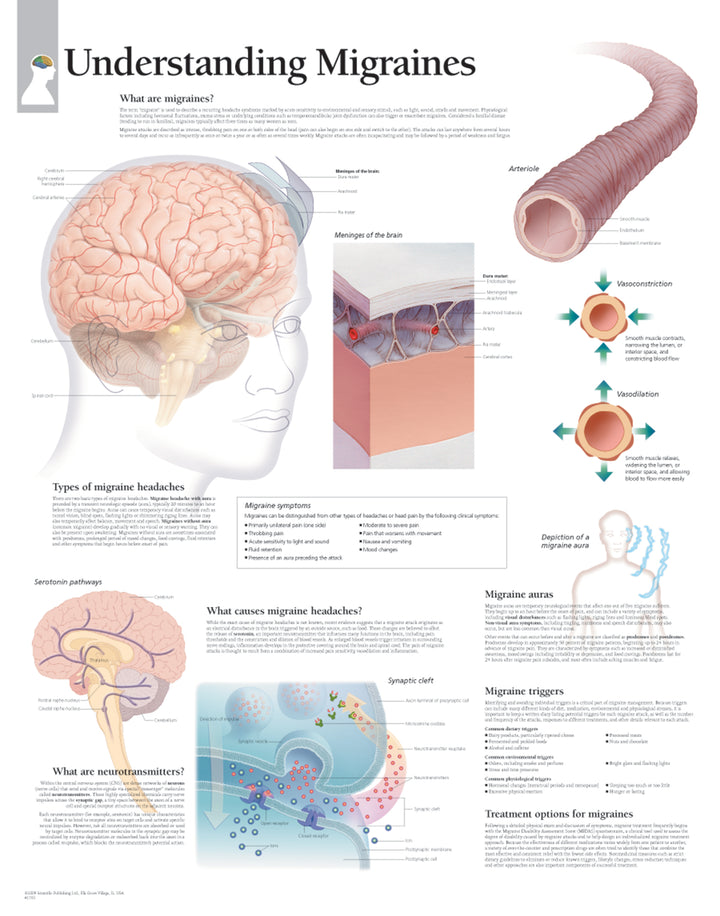 Chart - Understanding Migraines