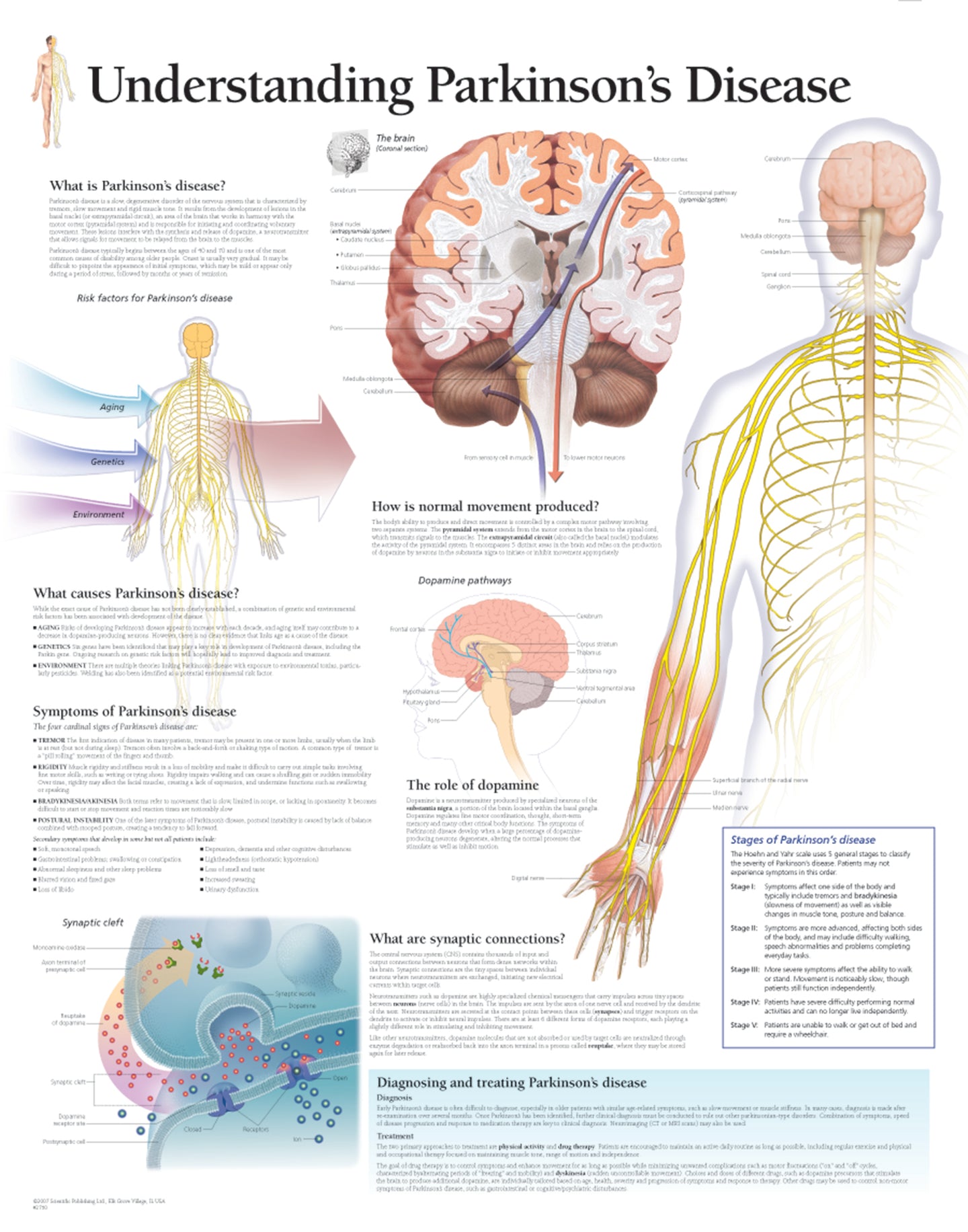 Chart - Understanding Parkinson's
