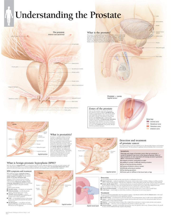 Chart Understanding Prostate 8875