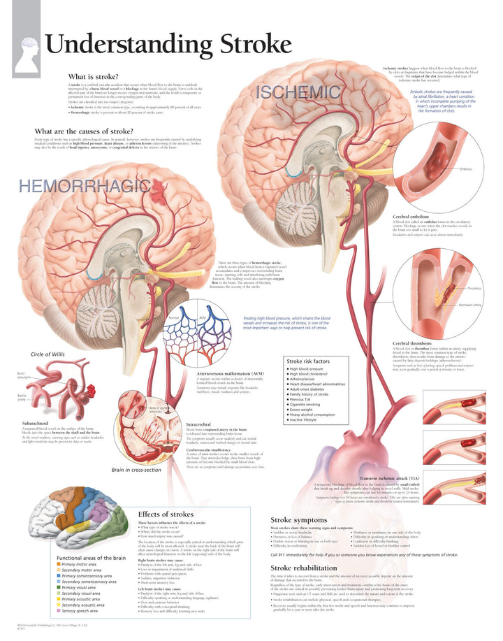 Chart - Understanding Stroke