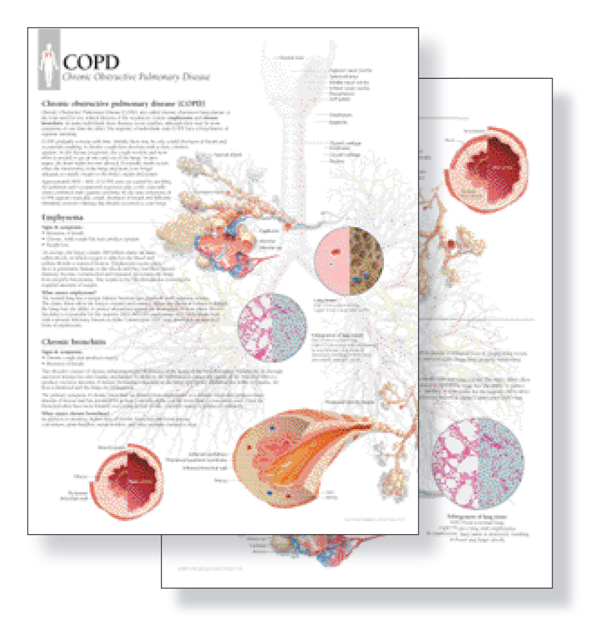 Replacement Pads - Understanding COPD Replacement Pads for Study Set