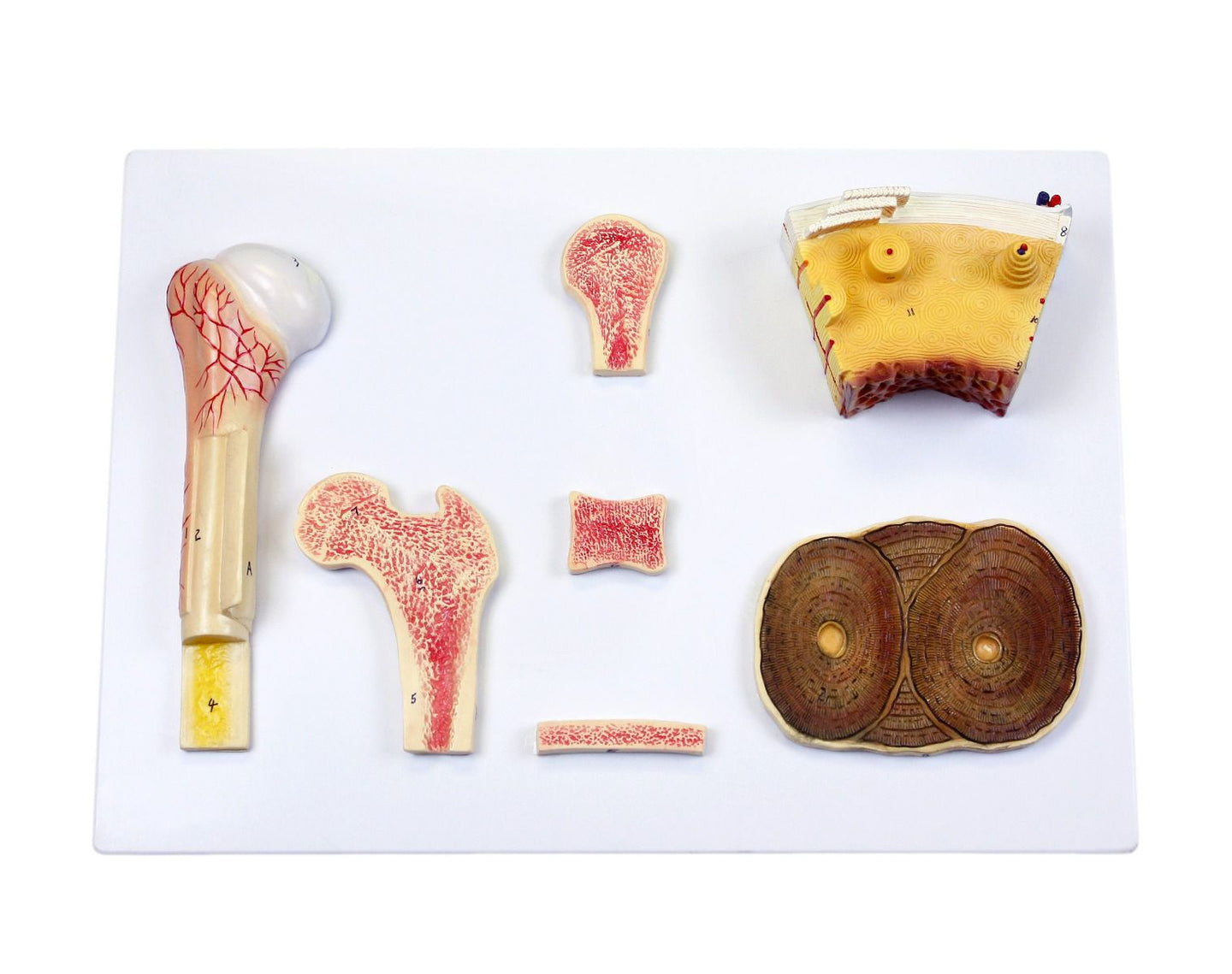 Bone Tissue Model