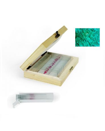 Budding Yeast Prepared Slide